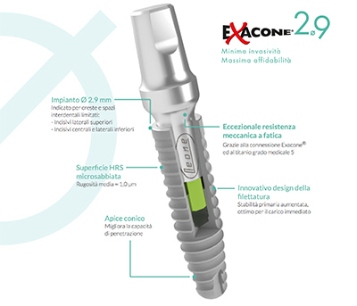 Exacone. 2.9: minima invasività e massima affidabilità | Odontoiatria33